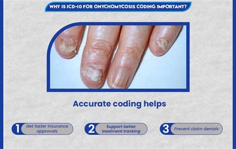 Icd 10 For Onychomycosis Nail Fungus Diagnosis Code Guide