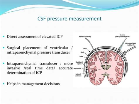 Csf Circulation Disorders Pptx