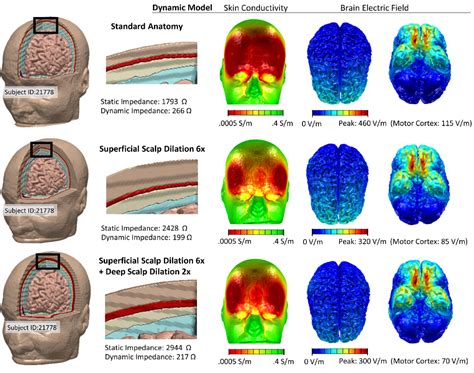 Pdf Adaptive Current Flow Models Of Ect Explaining Individual Static