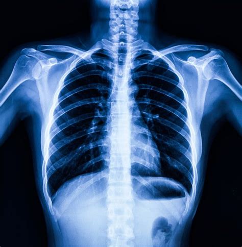 Imagenes Diagnosticas Curiosidades I Dudas X Ray Medical