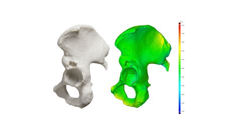 Form 4b：医療グレードの精度を、超高速造形で Formlabs