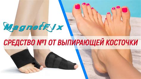 MagnetFix - лучшее средство от косточки на ноге.Магнитная вальгусная ...