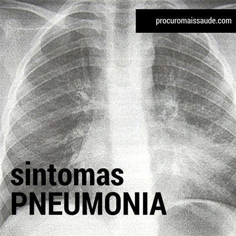 Sintomas De Pneumonia