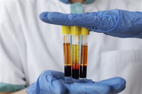 Unveiling The Science Behind Prtt And Prf Regenerative Potential Explored