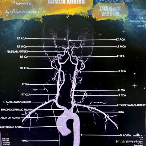 Alamin Parves On Linkedin Cta