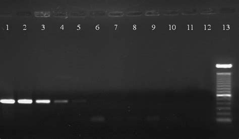 Detection Limit Of The Pcr Methodology For Detection Of M Dispar Download Scientific Diagram