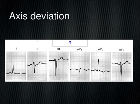 Ppt Axis Deviation Powerpoint Presentation Free Download Id1228942