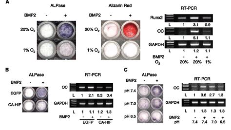 Figure From Hypoxia And Hypoxia Inducible Factor Expression Enhance Osteolytic Bone