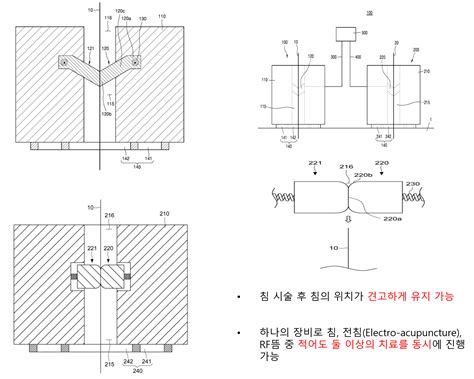 침 치료 장치 링크온비즈 기술거래