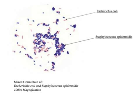 Staphylococcus Epidermidis 1000x