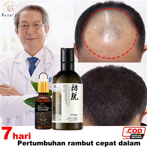 Jual ORI Shampo Penumbuh Rambut Cepat Serum Serum Penumbuh Rambut Rambut Rontok Botak