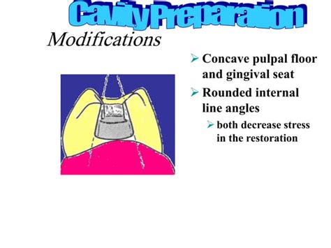 Classification Of Dental Caries Rasha Adel Copy Pptx