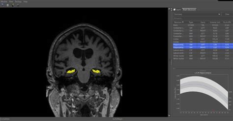Example Of Structural Magnetic Resonance Imaging Mri 24 Download