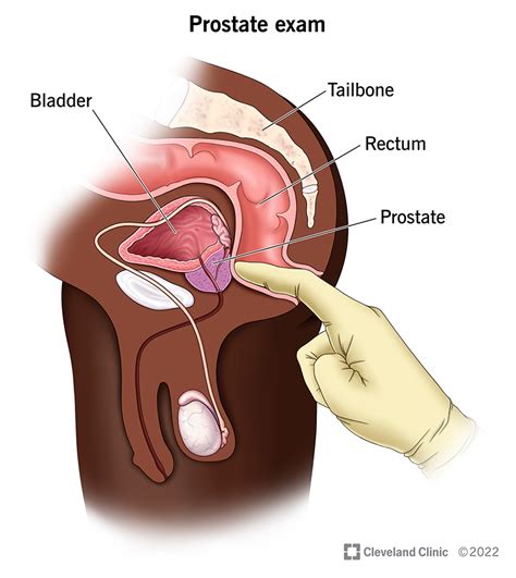 Prostate Exam Age Procedure What To Expect And Results