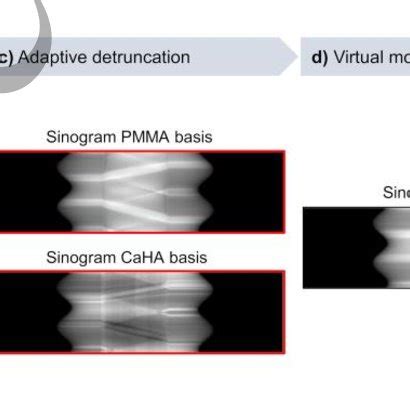 Image Processing Workflow First The Raw Projection Data Is Calibrated