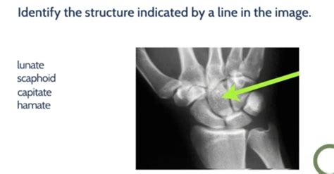 MSK Anatomy Flashcards Quizlet