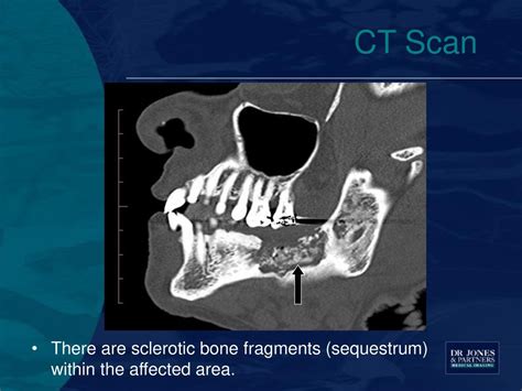 Dr Sarah Constantine Mbbs Franzcr Ppt Download