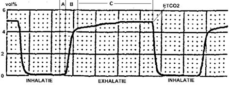 Capnography In Veterinary Anesthesia Owlcation