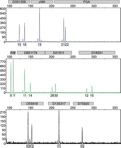 Dna Profile Recovery After Lpc Profile Derived From A Postcoital Download Scientific Diagram