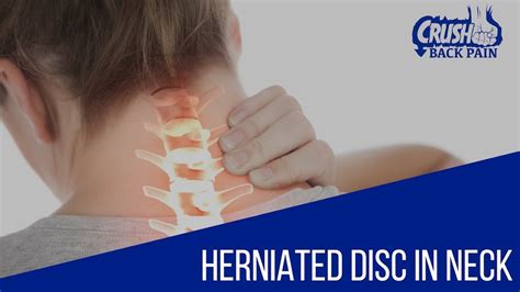 Herniated Disc In The Neck And Lower Back Symptoms Tr