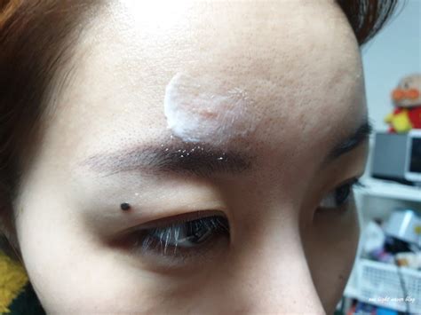 일본여드름연고 페어아크네사용법 네이버 블로그