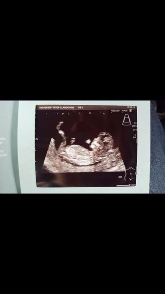 Guess The Sex Mumsnet