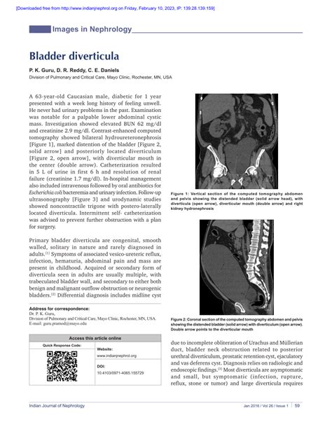 Pdf Bladder Diverticula