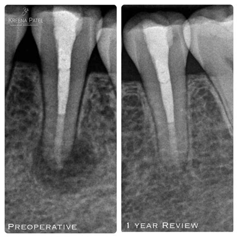 Kreena Patel On Linkedin Endoworks 10 Comments