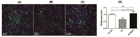 Figure 1 From Magnesium Isoglycyrrhizinate Reduces Hepatic Lipotoxicity