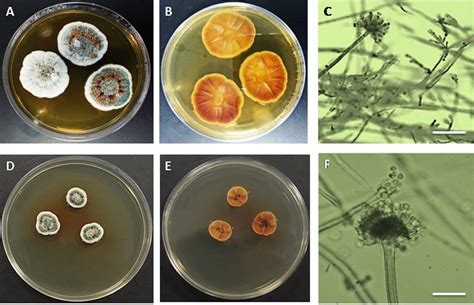 Aspergillus Versicolor Morphology