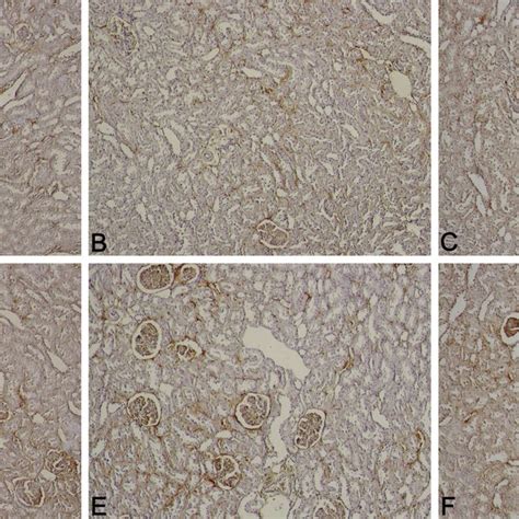 Immunohistochemical Expression Of Collagen Type I And V And Procollagen