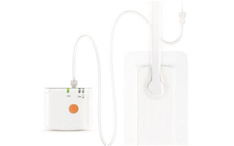 RCT Demonstrates PICO SNPWT Halving Surgical Site Infections In Caesarean Sections Hospital