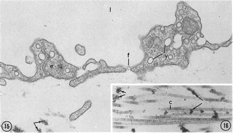 Example Of Complete Removal Of Basement Membrane And Anionic Sites From Download Scientific