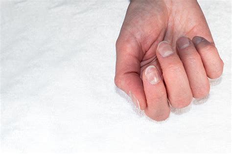 섬유 흰색 배경에 큐키클로 자란 천연 광택없는 손톱을 가진 백인 여성의 손 손톱에 대한 스톡 사진 및 기타 이미지 손톱