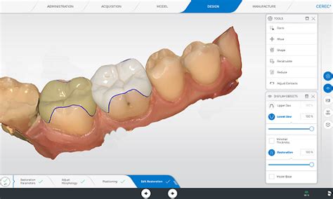 Cerec Software Dentsply Sirona Denmark