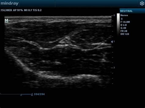 Dormed Hellas Mindray Dp 10 Diagnostic Ultrasound System