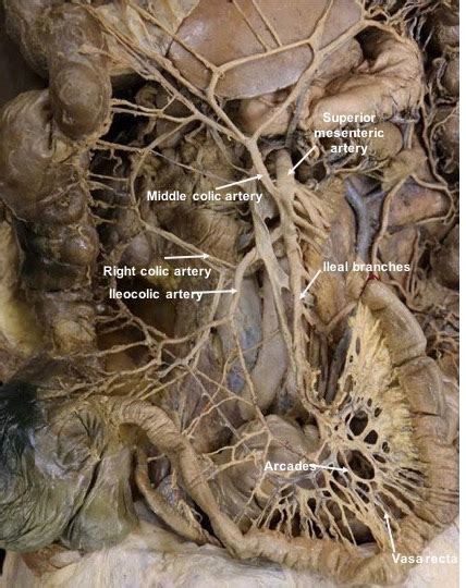 24 Abdominal Region Ii Ross University Anatomy Instructional Site