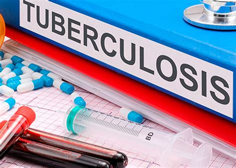 Nuevo Tratamiento Revoluciona La Lucha Contra La Tuberculosis