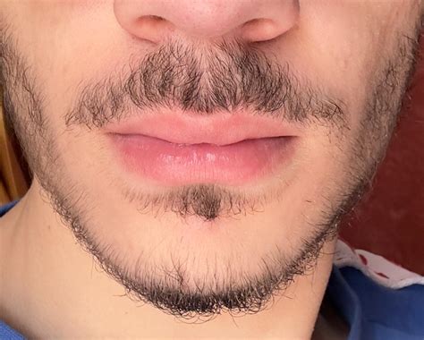 Its Normal For 1 Month Growth Keep It Or Shave Rmoustache