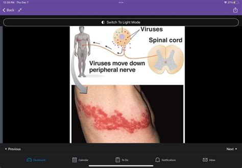 Microbiology Final Exam Flashcards Quizlet