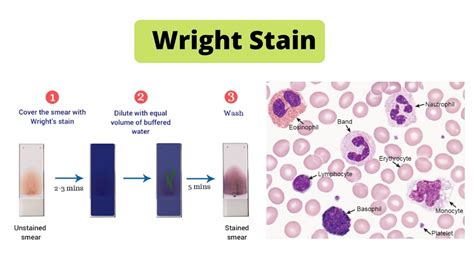 Negative Staining Principle Procedure Result Biology Notes Online