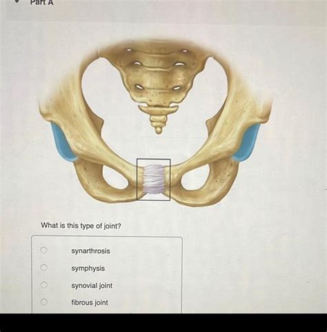 Answered What Is This Type Of Joint Synarthrosis Symphysis Synovial