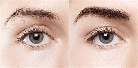 Castor Oil For Eyes 9 Surprising Benefits And How To Use It Castor