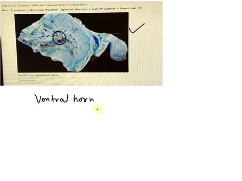 SOLVED Nervous System ANS And Special Senses Laboratory PAL Cadaver