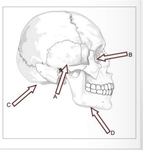 Transcranial Doppler Tcd Flashcards Quizlet Transcranial Doppler Tcd Flashcards Quizlet
