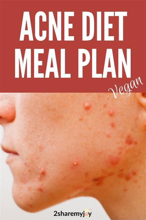 Hormonal Acne Diet Plan Best 7 Day Clear Skin Meal Plan Pdf Acne