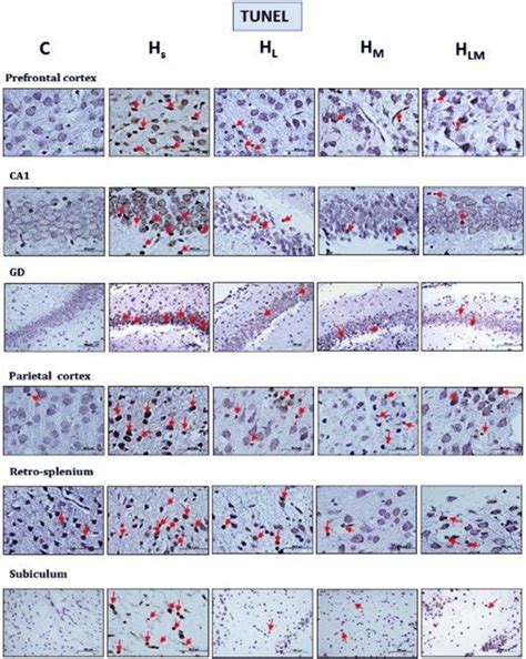 Apoptotic Cells Evaluated By Tunel In Prefrontal Cortex Hippocampal Download Scientific