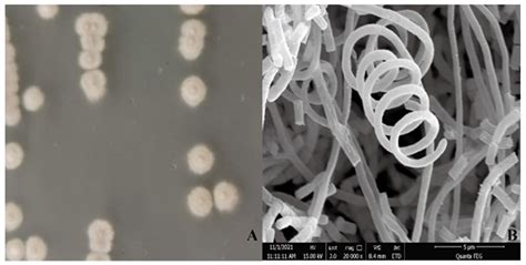 Antagonism Of Rhizosphere Streptomyces Yangpuensis Cm253 Against The