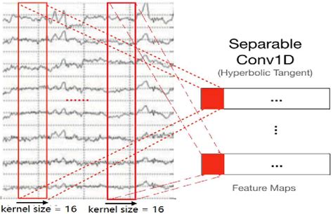 Figure 1 From Enhancing P300 Feature Extraction Through Multi Scale