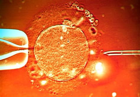 Ivf After Tubal Ligation Cny Fertility